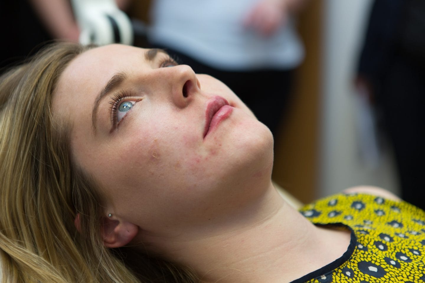 Chantelle | Transform Glasgow Cosmetic Surgery Clinic